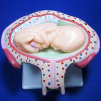 China Take Your Medical Training to the Next Level with Anatomical Pregnancy Simulators for sale