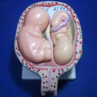 China Take Your Medical Training to the Next Level with Anatomical Pregnancy Simulators for sale