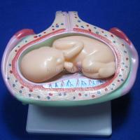 China Take Your Medical Training to the Next Level with Anatomical Pregnancy Simulators for sale