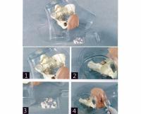 China Obstetrics-Gynecology Model Transparent Uterine Curettage Simulator for Nurse School for sale