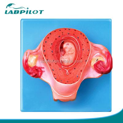 China Advanced PVC Uterus Model for Second Month Pregnancy Anatomical Uterus Demonstration for sale
