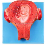 China Advanced PVC Item Pregnant Embryo Model Third Month Uterus with Umbilical Cord Model for sale
