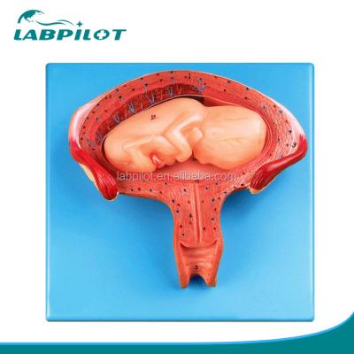 China Medical Science Manikin Fourth Month Embryo Model for Pregnant Uterus and Ovary Anatomy for sale