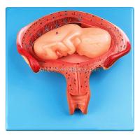 China Medical Science Manikin Fourth Month Embryo Model for Pregnant Uterus and Ovary Anatomy for sale