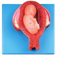 China Vivid Human Histoembryology Model Fifth Month Embryo Fetus and Uterus Anatomical Model for sale