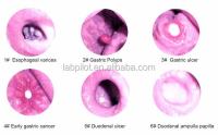 China Advanced Gastroscopic Examination and ERCP Training Model for Gastrointestinal Lesions for sale