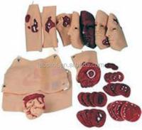 China Emergency Skills Training Model Advanced PVC Facial Burn Trauma Evaluation Model for sale