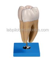 China Detailed Anatomy Structures of Adult Lower Molar Teeth Advanced PVC Dental Care Model for sale