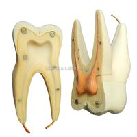 China Dental Care Demonstration Detachable Anatomical Teeth Model for Three-Root Molar Teeth for sale