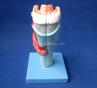 China Advanced PVC Anatomical Demonstration Detachable Larynx Model with 33 Anatomy Marks for sale