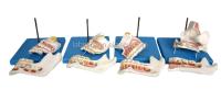 China Function Demonstrate Lower Molar Teeth Detailed Anatomy Structures for Dental Research for sale