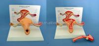 China Advanced PVC Human Uterus and Ovary Model for Women's Reproductive System Education for sale