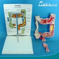 China Ophthalmological Anatomical Models Human Intestine Model for Colon and Rectum Diseases for sale