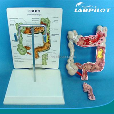 China Ophthalmological Anatomical Models Human Intestine Model for Colon and Rectum Diseases for sale