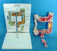 China Ophthalmological Anatomical Models Human Intestine Model for Colon and Rectum Diseases for sale