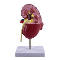 China PVC Pathological Kidney Model for Medical Schools and Urology Hospitals Demonstration for sale