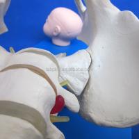 China Vivid Pelvis and Fetal Heads Advanced PVC Model for Childbirth Skills Demonstration for sale