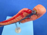 China Educational Demonstration Model of Human Life Size Pancreas with Spleen and Duodenum for sale
