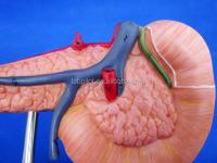 China Educational Demonstration Model of Human Life Size Pancreas with Spleen and Duodenum for sale