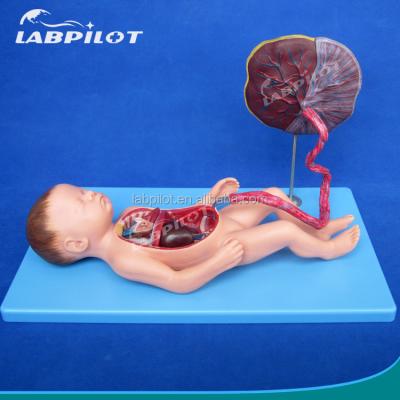 China Medical Science Painted Fetal Circulation Model with Heart Placenta and Umbilical Cord for sale