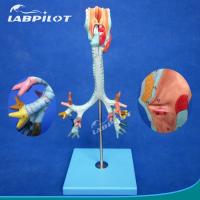 China Medical Science Display Detachable Bronchial Tree and Trachea Model for Larynx Anatomy for sale