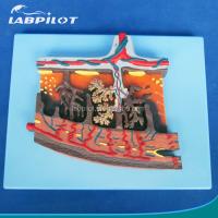 China Vivid Placenta Model 3D Placenta Tissue and Umbilical Cord for Anatomy Demonstrations for sale
