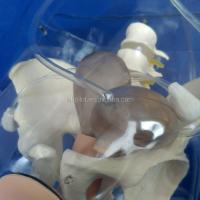 China Manikin Transparent Dilatation and Curettage of Uterine Manikin for Abortion Training for sale