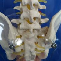 China Manikin Transparent Dilatation and Curettage of Uterine Manikin for Abortion Training for sale