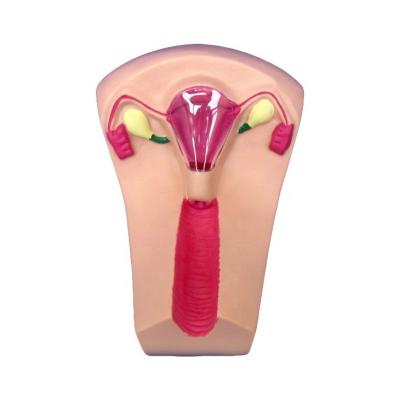 China Medical Science PVC IUD Insertion Trainer Uterus Female Intrauterine Device Simulator Model for sale
