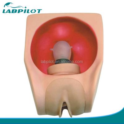 China Human Life Size Medical Science Training Model for Advanced Female Contraception Practice for sale