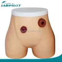 China Advanced PVC Ostomy Nursing Model for Ileostomy and Colostomy Training in Hospitals for sale