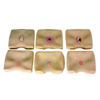 China Buttock Skin Decubitus Ulcers Simulator for Hospitals Improve Bedsore Nursing Training for sale