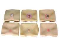 China Buttock Skin Decubitus Ulcers Simulator for Hospitals Improve Bedsore Nursing Training for sale