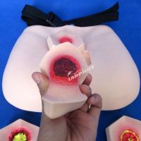China Patients Care Demonstration Pressure Sores Nursing Model Stage Bedsore Teaching Model for sale
