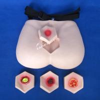 China Patients Care Demonstration Pressure Sores Nursing Model Stage Bedsore Teaching Model for sale
