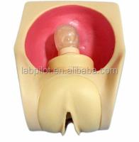 China OB and GYN Nursing Training Simulator Female Contraception Practice Model with Vagina for sale