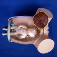 China Obstetrics-Gynecology Model Pregnant Woman Care Simulator for Obstetrics Training for sale