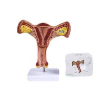 China Female Internal and External Genital Organs Model Medical Science for Human Life Size for sale