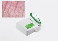 China 8 Report Acne Skin Analyzer Machine Connect With Computer Give Report for sale