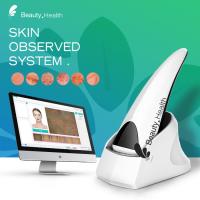 China Customers manage system USB skin observed system skin analyser machine for sale