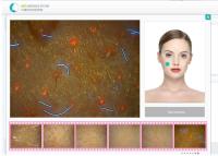 China User friendly portable Skin Analyzer Machine / Skin Scanning Machine 110V / 220V for sale