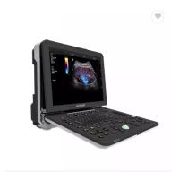 China Cardiovascular Cardiology Portable Full Figital Color Doppler Ultrasound Scanner Machine for sale