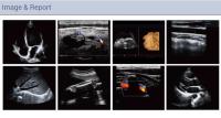 China Cardiovascular Cardiology Portable Full Figital Color Doppler Ultrasound Scanner Machine for sale