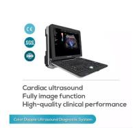 China Cardiovascular Cardiology Portable Full Figital Color Doppler Ultrasound Scanner Machine for sale