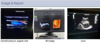 China 2D 3D 4D Echocardiography Cardiac Trolley Echo Color Doppler Ultrasound Machine for sale
