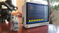 China Vital Signs Patient Monitor 15 Inch Multiparameter Medical ICU Bedside Nibp SPO2 Ecg for sale