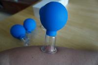 China Blue 4 Pcs Glass Vacuum Cupping Set Therapy  Cups  Fire Cupping Kits Chinese Traditional Massage Reduce Fine Lines for sale