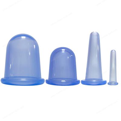 China Reusable 6.8 5 3.6 1.5cm Silicone Vacuum Anti Cellulite Cupping Set for sale