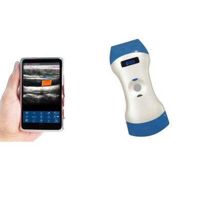 China Handheld Wireless Mini B Color Doppler Ultrasound Probe for sale