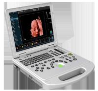 China Color Doppler Portable Ultrasound Machine 15 inch LED medical display able to reverse it above 160 degree for sale